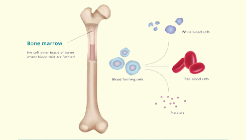 Miraculous double birth: Mother’s bone marrow transplant saves infant ...