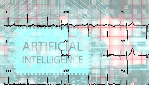 AI-ECG Model shows promise in identifying patients needing urgent heart care
