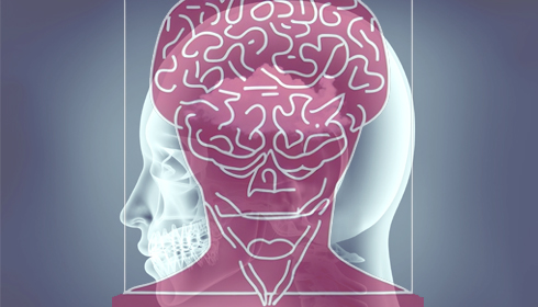 Neuro Rehabilitation: A Comprehensive Approach to Recovery