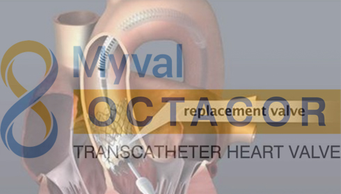 Questions Linger on Long-Term Benefits Even as Meril's Myval THV Series ...