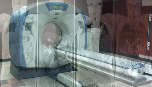 Automated Multiorgan CT Scans revolutionise Diabetes and ...